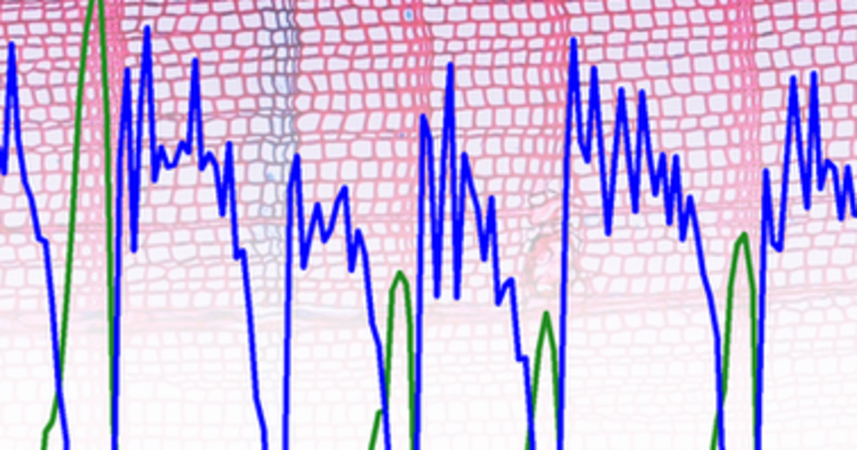 XELLCLIM - Benchmarking xylem cell anatomy for tree-ring based climate ...