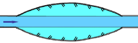 Local river widening